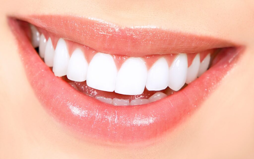 Hollywood Smile Makeover - NorthView Dental | Your London Dental Clinic